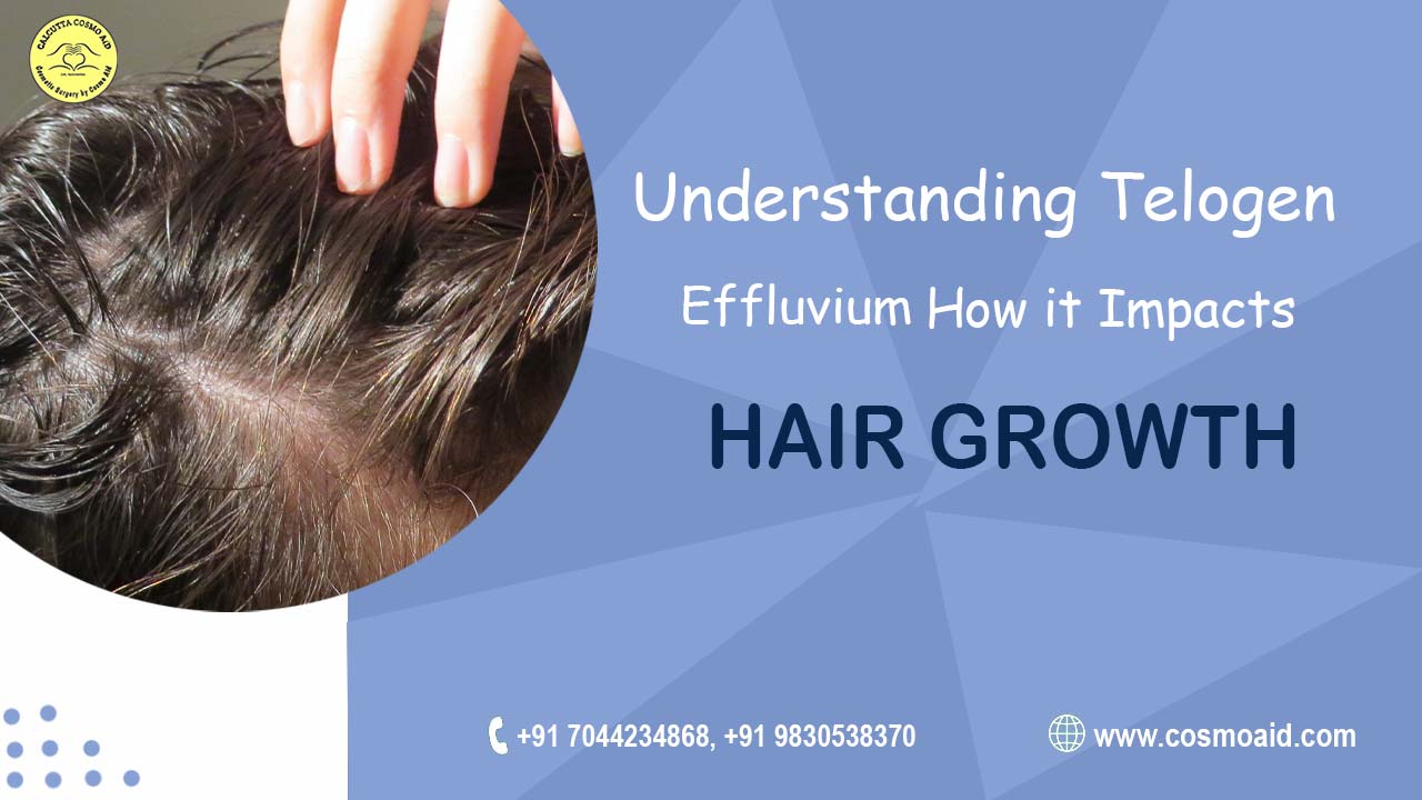 Understan How Telogen Effluvium impacets your hair growth