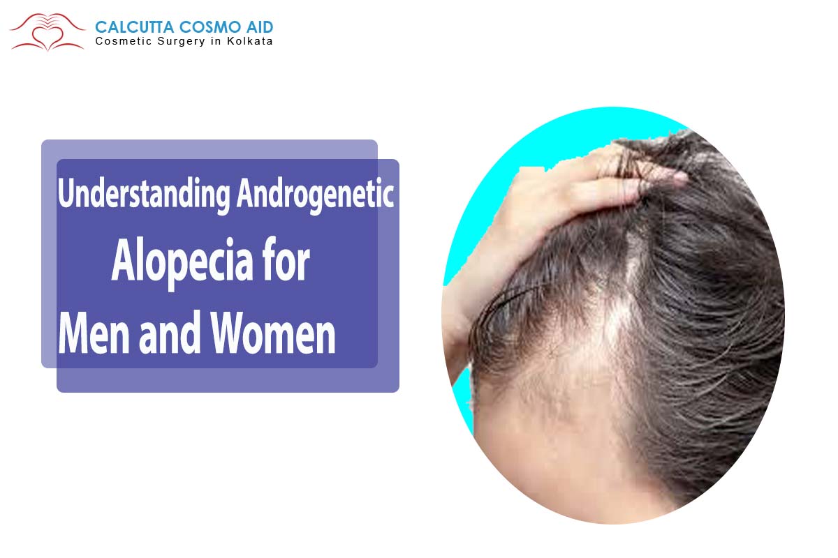 Understanding Androgenetic Alopecia: A Comprehensive Guide for Men and Women - Cosmo aid