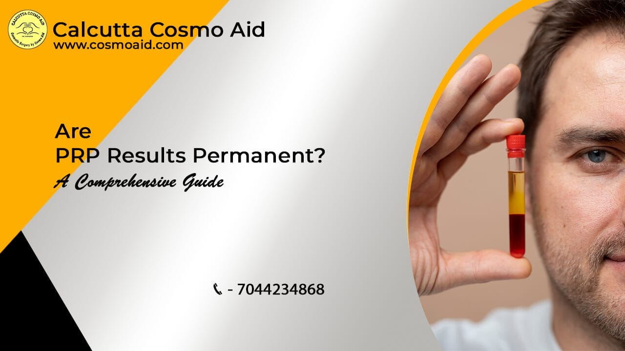 Are PRP Results Permanent? A Comprehensive Guide to PRP Therapy and its Longevity - Cosmo aid
