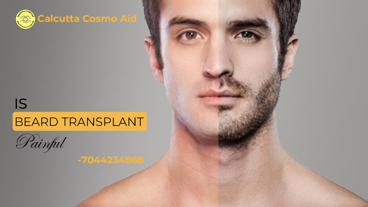 Is Beard Transplant Painful ? A Comprehensive Guide - Cosmo aid